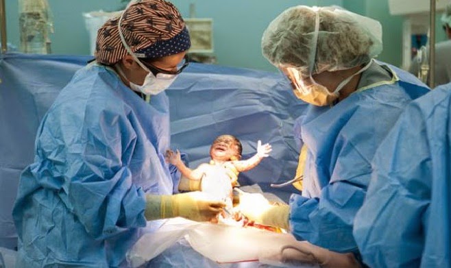 Bersalin melalui pembedahan caesarean. Boleh pilih ke?