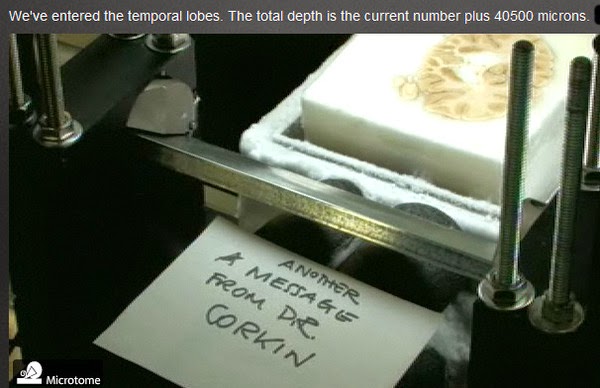 The Neurocritic: The Life and Brain of H.M.