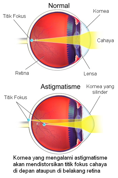 AYO!! Cek Kesehatan Mata Dengan Tes Mata Silinder Ini - Sains Ph.D
