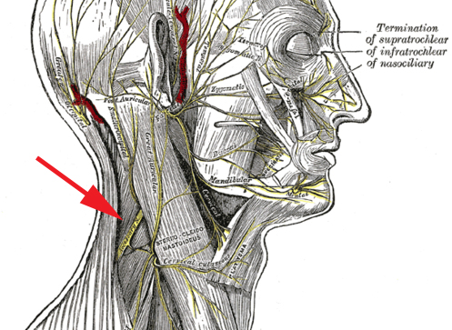 Malpractice Lawsuit for Nerve Damage Sustained After Neck Cyst Excision ...