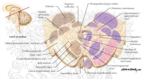 myneurologytips: Midbrain section