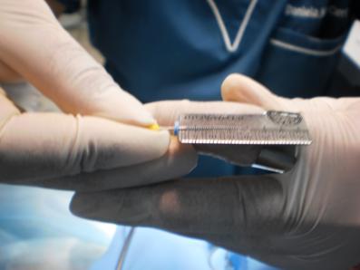 EL ANGEL DE TUS DIENTES : TRATAMIENTO DE CONDUCTOS