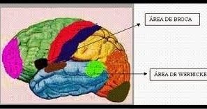 Fonoaudiologia: Saúde e Comunicação: Área de Broca e Área de Wernick ...