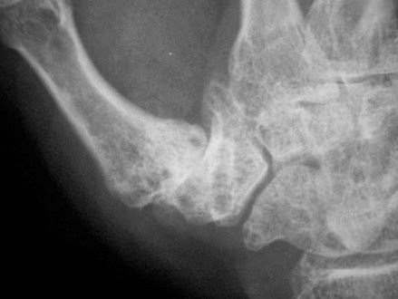 Optativa DDI 2014: Caso discutido em 28/03 - Musculoesqueletico