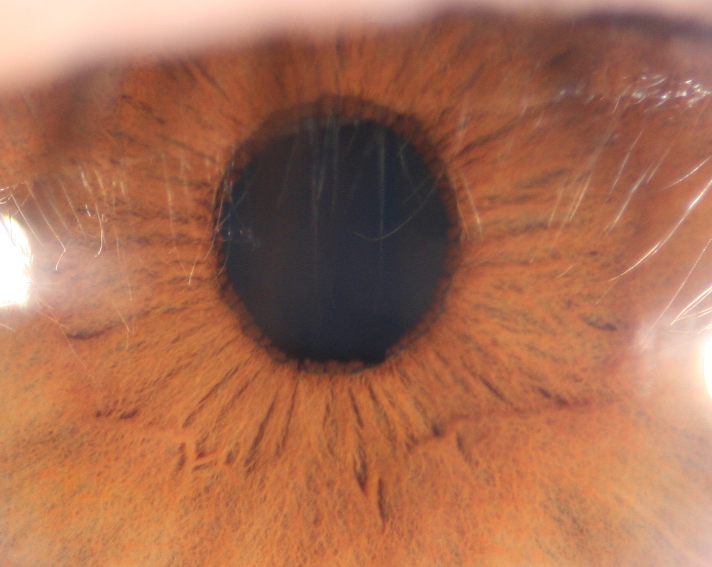 Modern & Multidimensional Iridology: Important Iris Signs at IPB, Pupil ...