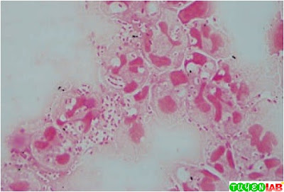 [Microbiology] Atlas of Infections of the Central Nervous System | Free ...