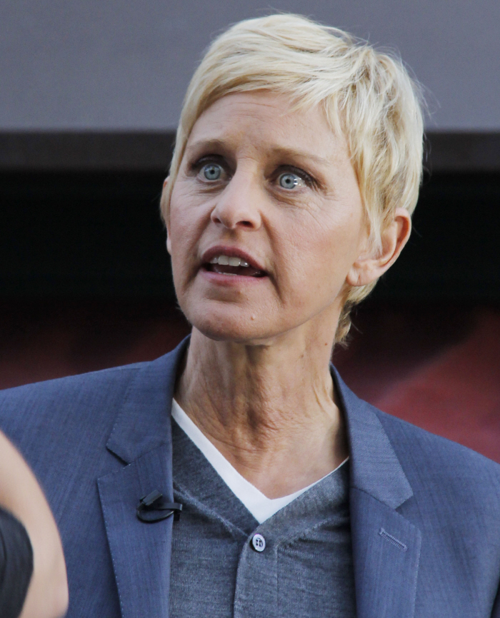 Ellen DeGeneres Plastic Surgery