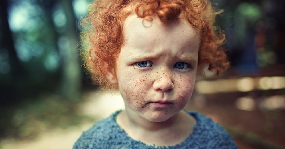 Es Asombroso: Algunas pecas pueden presentar síntomas de una enfermedad ...