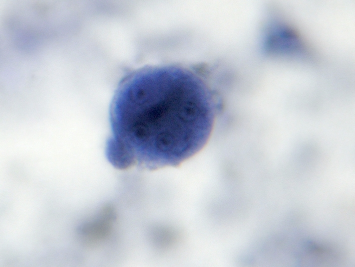 Fun With Microbiology (What's Buggin' You?): Entamoeba histolytica/dispar