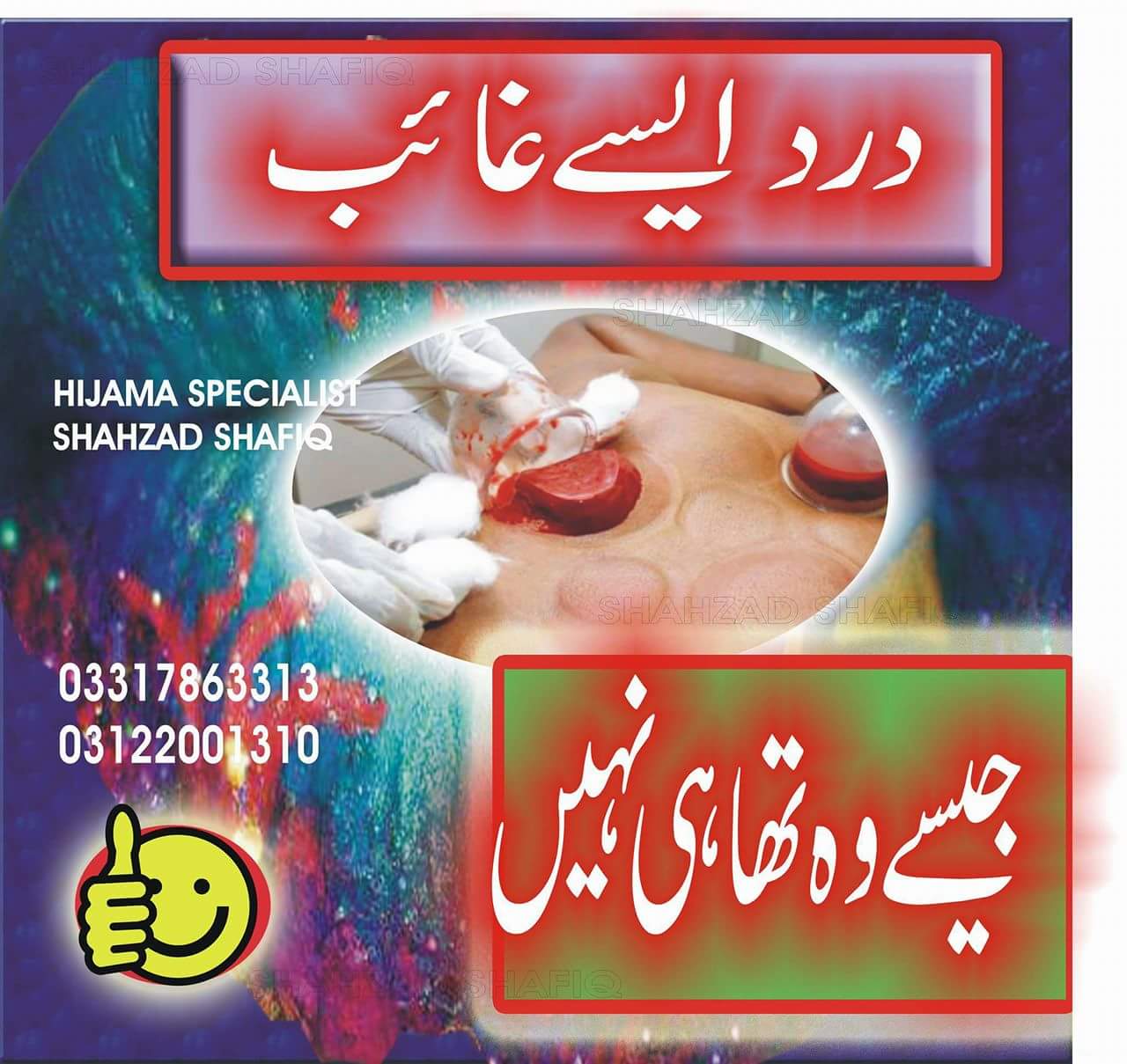 Hijama : Hijama points . # Hijama benefits # Hijama Karachi #Hijama ...