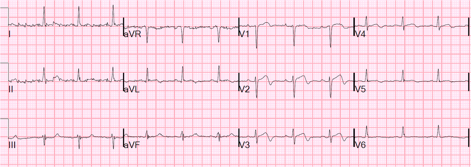 Medical Laboratory and Biomedical Science: Dr. Smith's ECG Blog