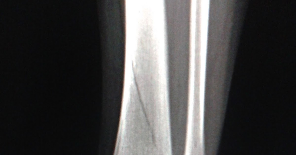 DICAS DE RADIOLOGIA - Tudo Sobre Radiologia: IMAGENS RADIOLÓGICAS ...