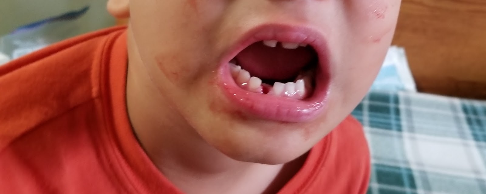 How My Son Lost His First Tooth