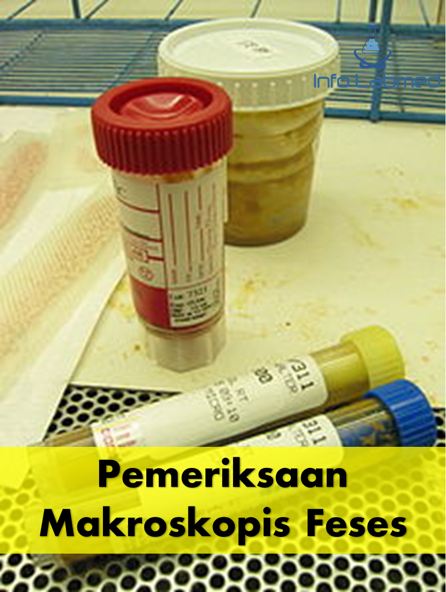 Pemeriksaan Makroskopis Feses