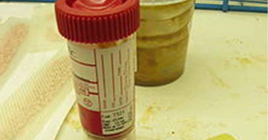 Pemeriksaan Makroskopis Feses