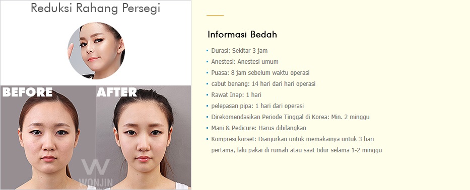 Apa itu operasi reduksi rahang persegi?
