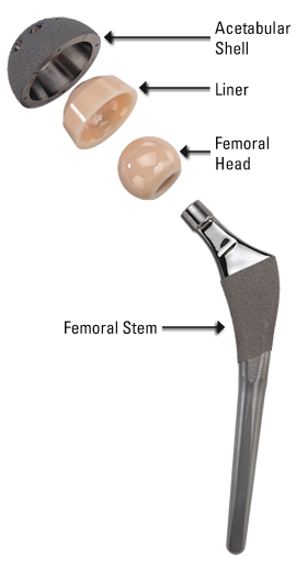 Living The New York Kind Of Life...With Lupus: April 2011