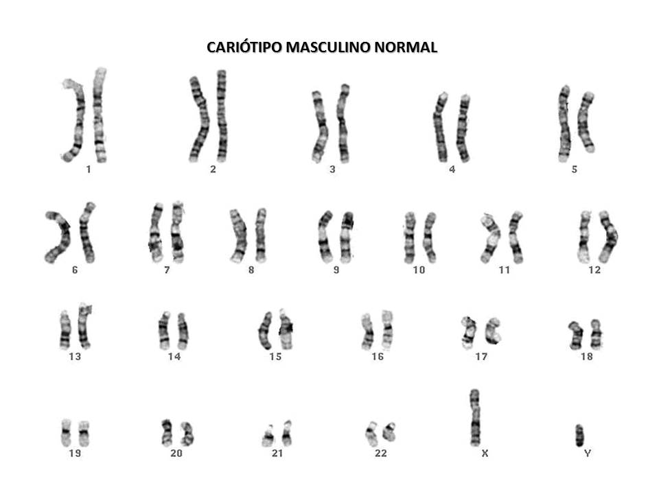 Genética humana - Cariótipo