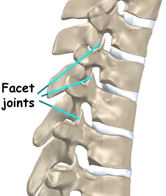 The Halo Diaries: Cervical Spine Fusion Surgery