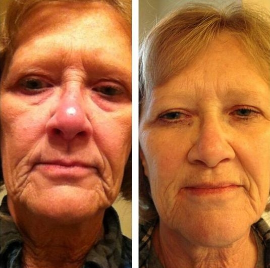 Natural Chinese Facelift: Age-Shedding Using Facial Yoga : Firm Up ...