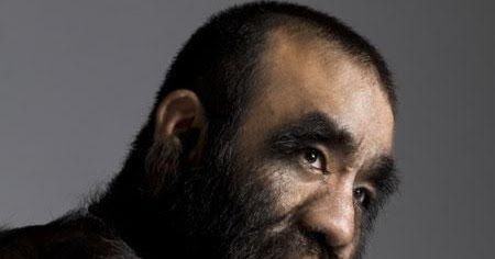 Welcome to 12AMN Blog!: Hairy like wolverine disease, which is genetic ...