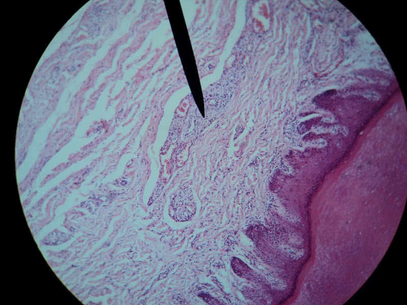 MEDICINA USMP: FOTOS DE HISTO