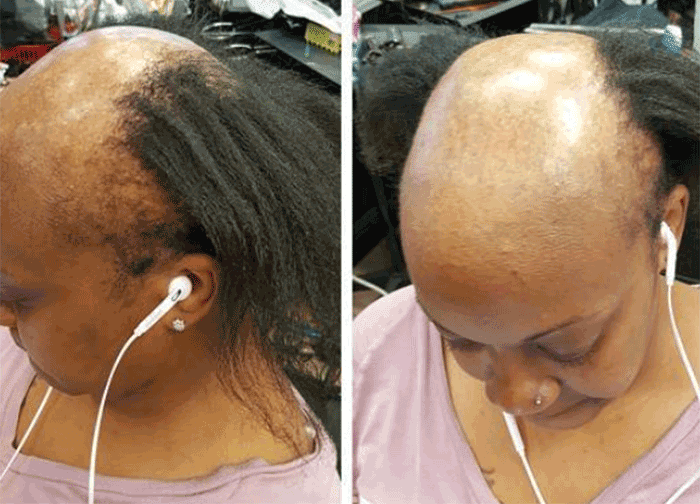Hairstylist amazingly transforms bald woman's head (photospeak) - Kemi ...