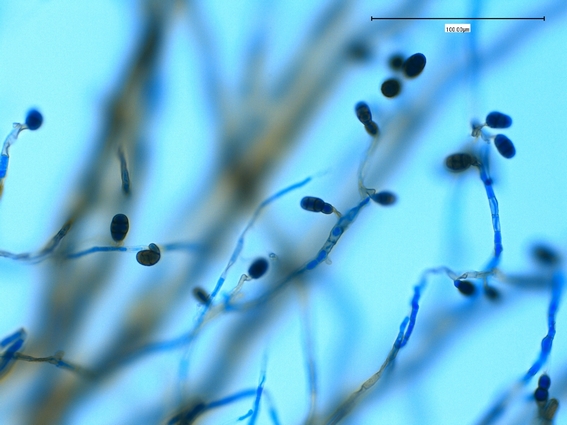 Fun With Microbiology (What's Buggin' You?): Pithomyces species