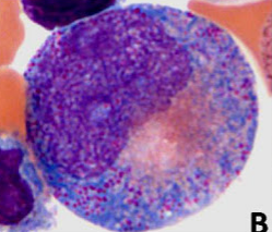 FICHERO DE HEMATOLOGÍA: Morfología normal de elementos celulares ...