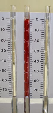 Miyo Spiral: Práctica 7 Velocidad de Sedimentación Eritrocitario (VSE)