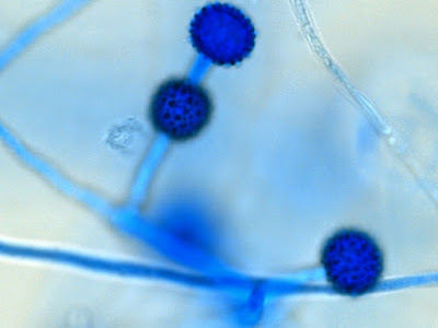 Fun With Microbiology (What's Buggin' You?): Sepedonium species