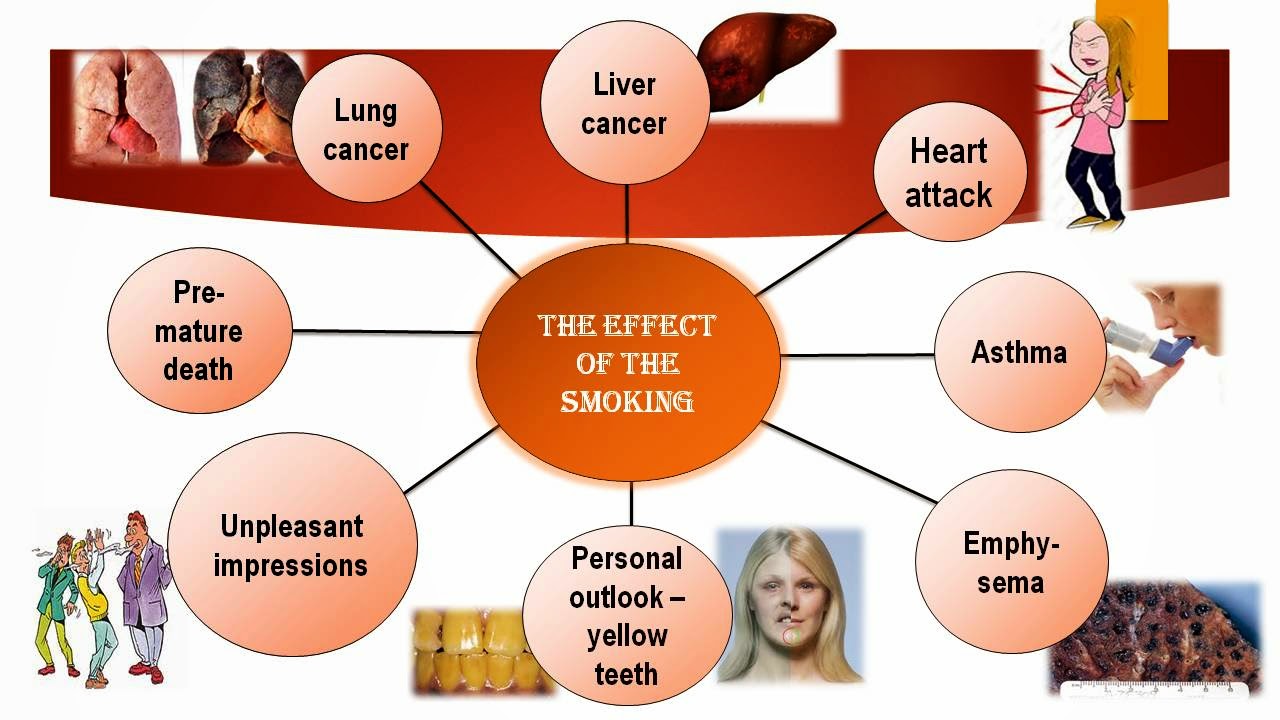ShiHui0817: Healthcare - Smoking ( I-think Map)