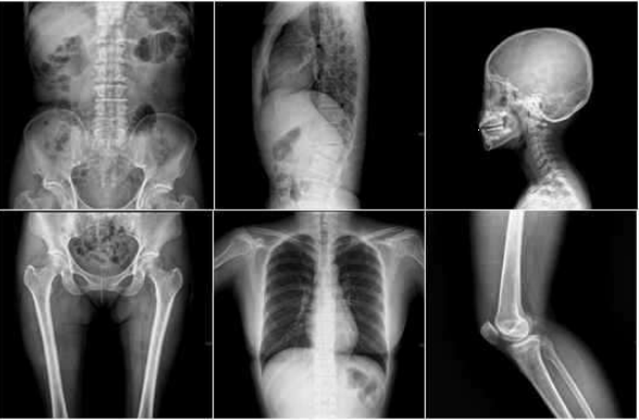 BlogFolio IR Diego Vargas: FUNDAMENTOS DE LOS EXAMENES RADIOGRAFICOS ...