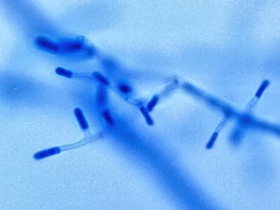 Fun With Microbiology (What's Buggin' You?): Trichophyton terrestre