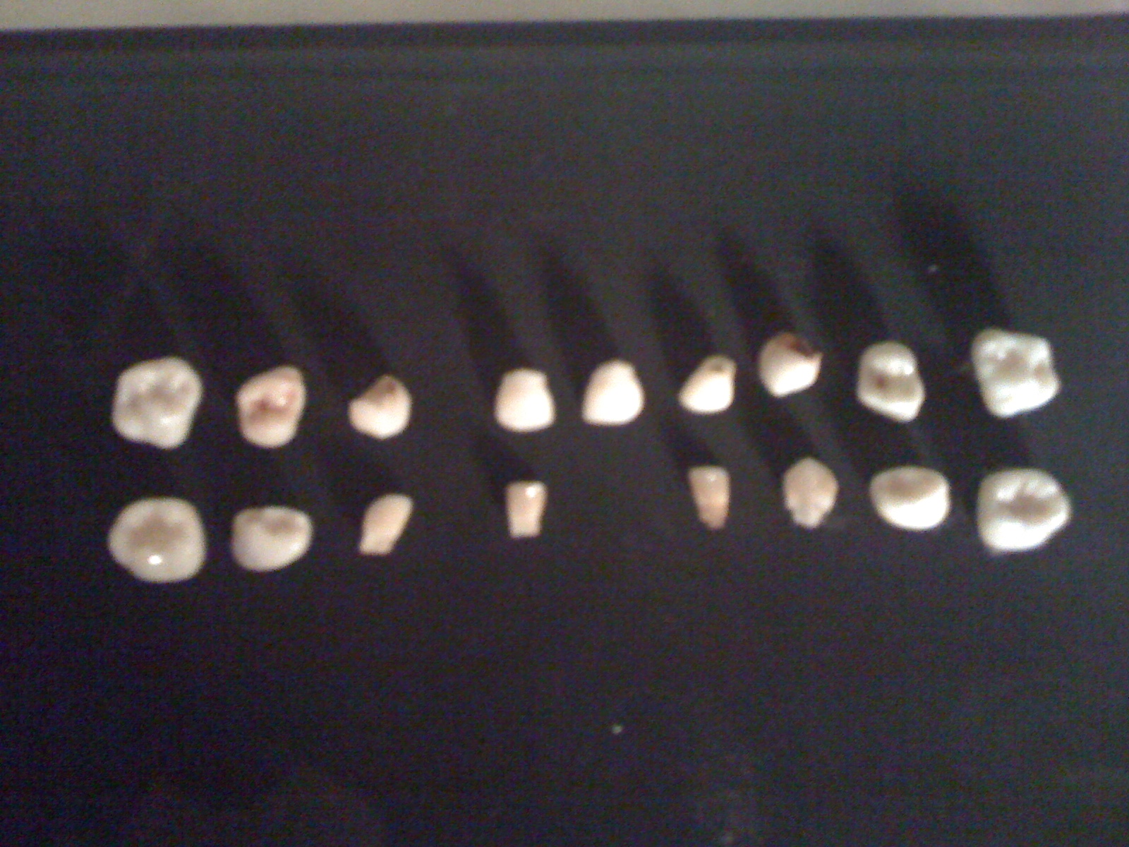 Wetherby Orthodontics, Our Blog: Goodbye to the Tooth Fairy