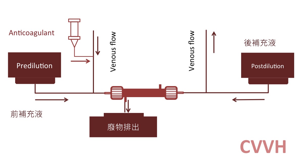 陳鋭溢: 連續性腎臟替代療法