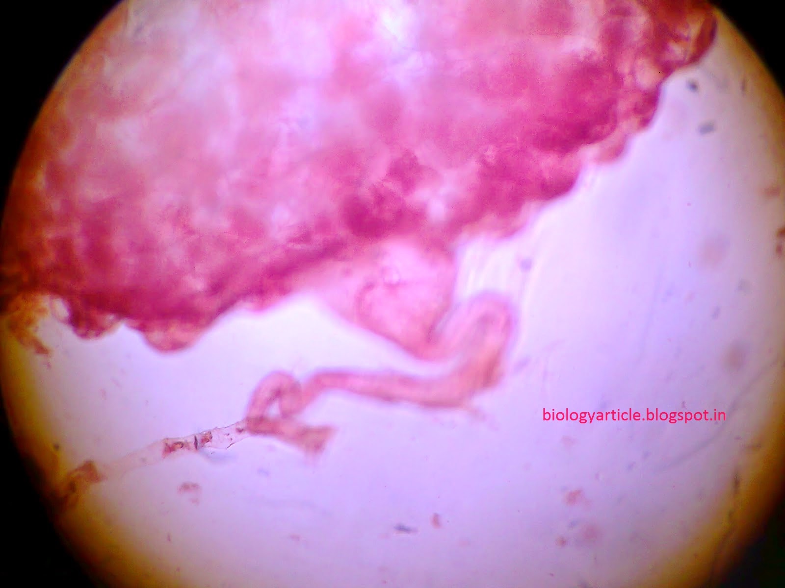 BIOLOGY WRITE-UP - BIOLOGY ARTICLES: HAUSTORIUM (haustoria): structure ... BIOLOGY WRITE-UP - BIOLOGY ARTICLES: HAUSTORIUM (haustoria): structure ...