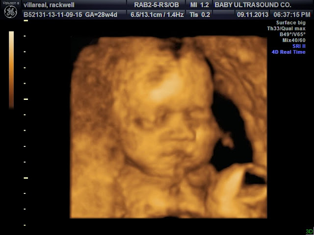 Our Journey Towards Parenthood: Rhian’s First Baby Photos (3D/4D – Baby ...