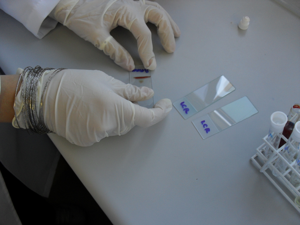 Citologia Clínica - 2011: LCR - Câmaras