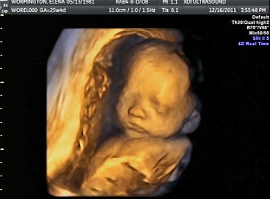 Our Little Worm: 25 weeks 3d ultrasound!
