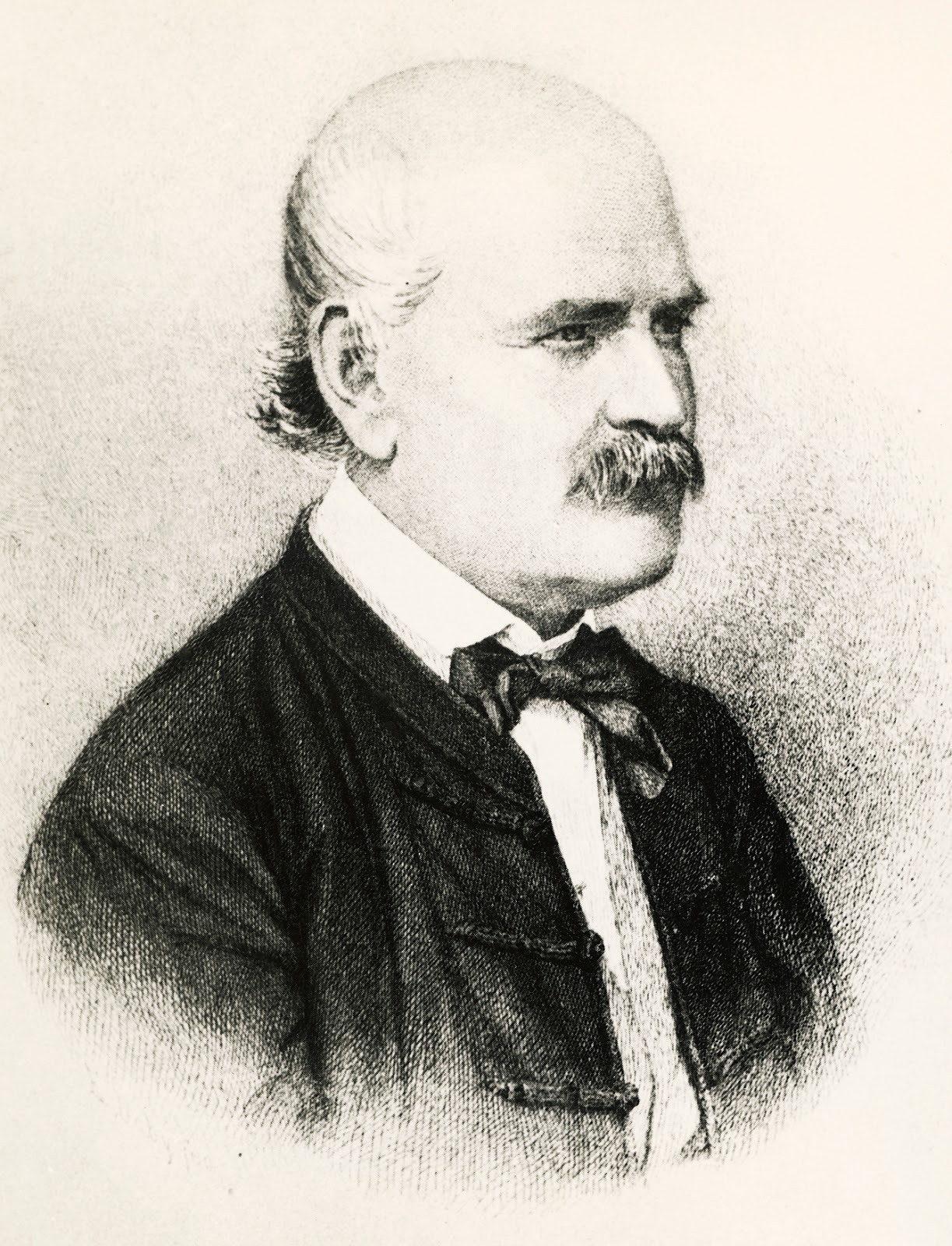 Ignaz Semmelweis