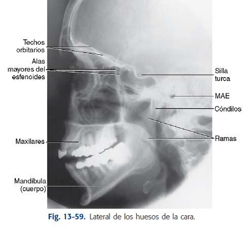 PRODUCCION Y TRATAMIENTO DE IMAGENES DIAGNOSTICAS: CAPITULO HUESOS ...
