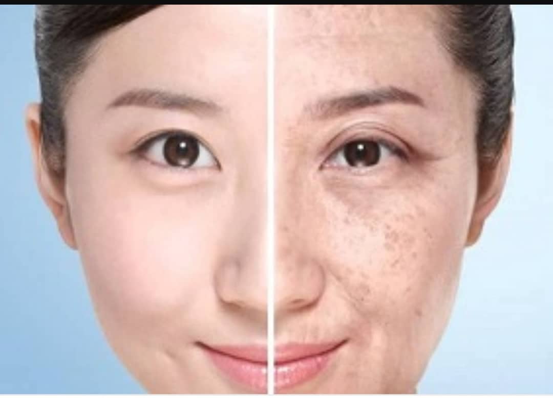 Punca dan Penyelesaian Jeragat - Tips Kurus Cepat Dan Berkesan