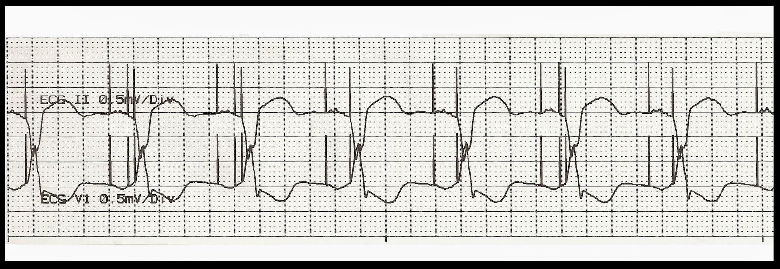 Practice EKG Rhythm Strips 233