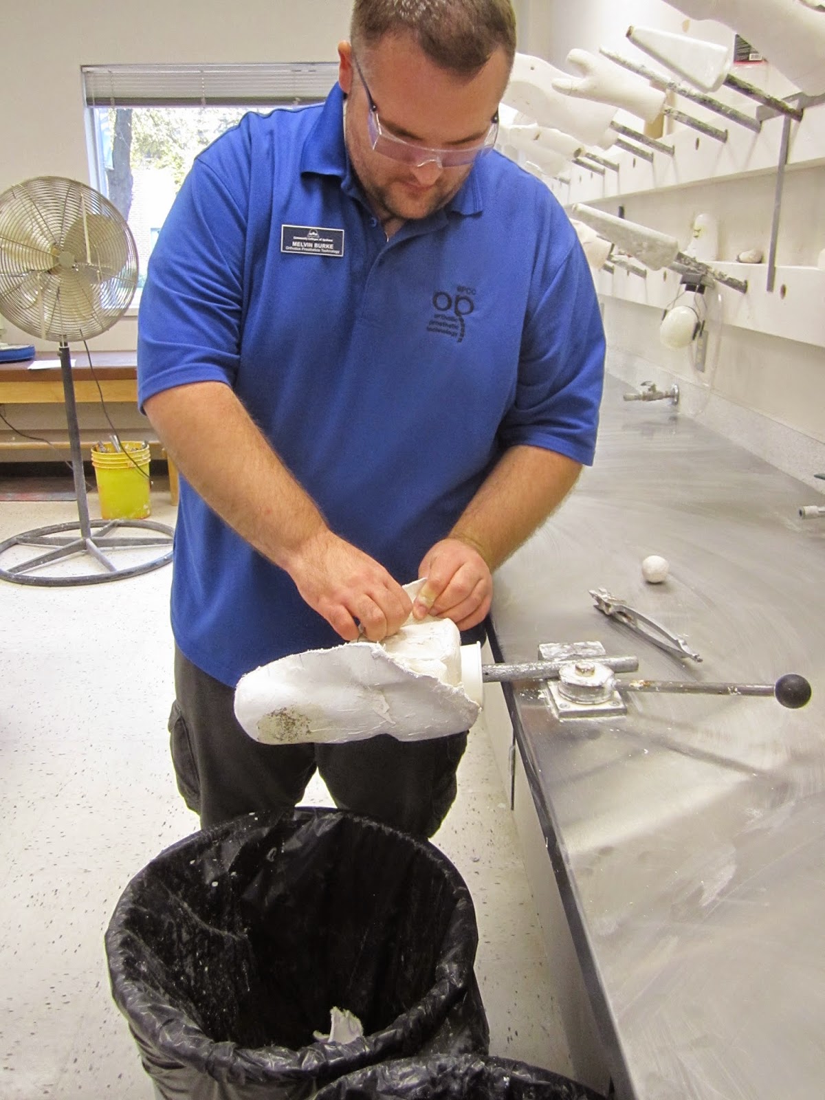 Prosthetic Projects: PTB Exoskeletal Prosthesis