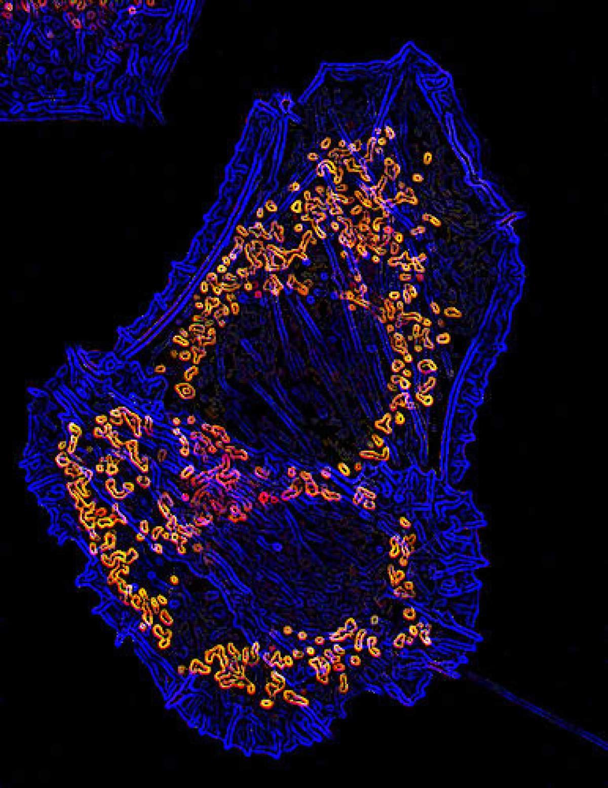 Ψυχεδελική τέχνη στο μικροσκόπιο [video] | preludiance