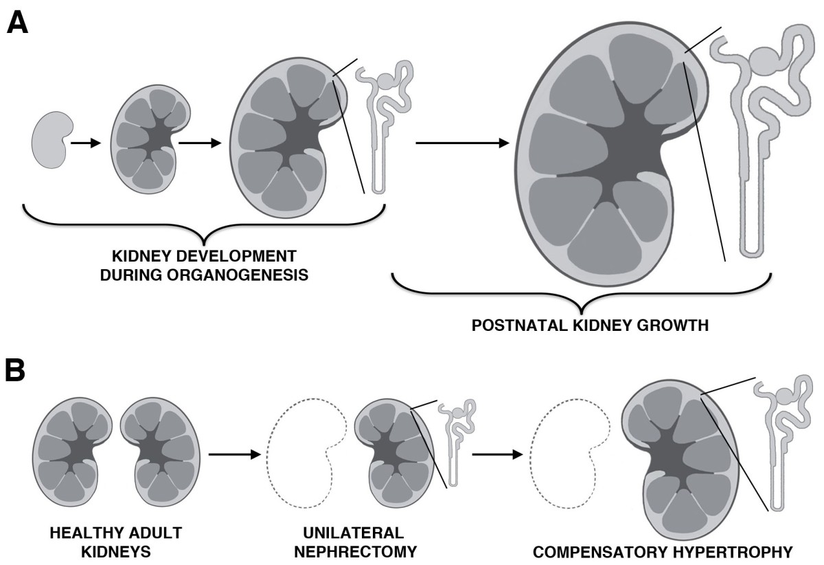 Nephrology's Hidden Nemesis: A Look Into the BK Virus and its Relation ...