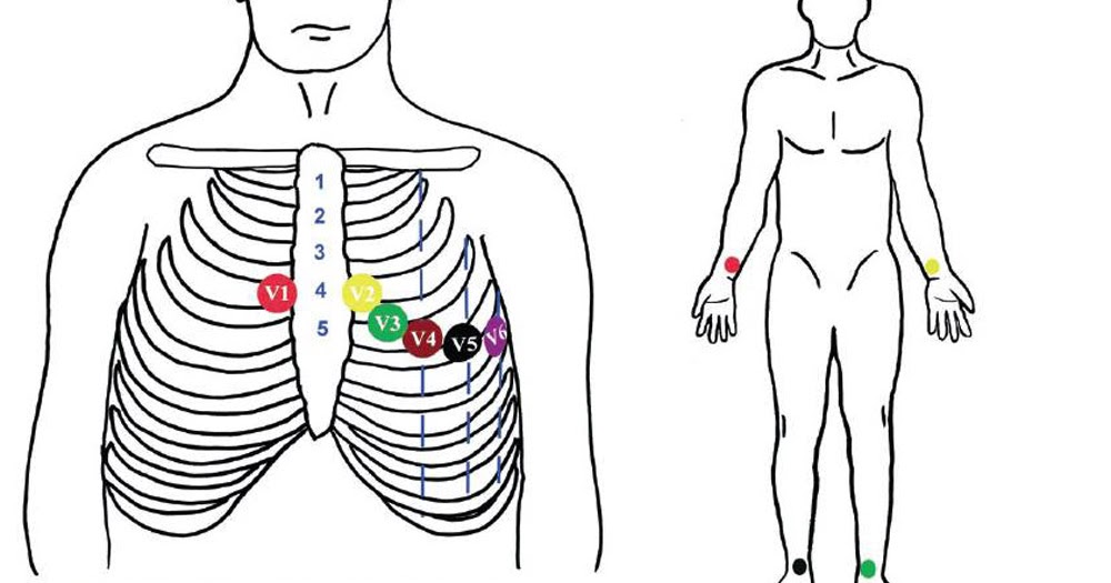 Enfermeras a cuadros: Electrocardiograma, la actividad del corazón.
