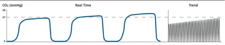 EM Didactic: Capnography beyond ROSC