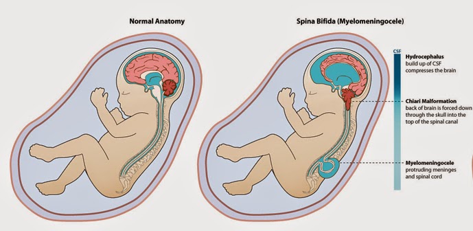 BUMPY MIRACLE: Double Marker Test and Triple Marker Test FAQs